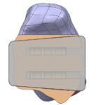 Vantage Ankle Mobile Bearing System | Exactech