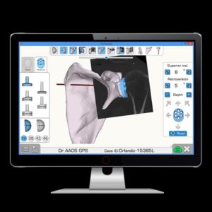 Active Intelligence | Exactech