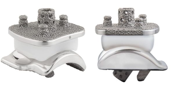 Vantage Ankle Mobile Bearing System | Exactech