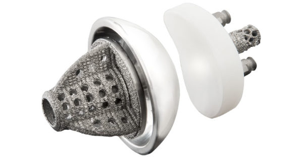 Equinoxe Stemless Shoulder | Shoulder | Exactech