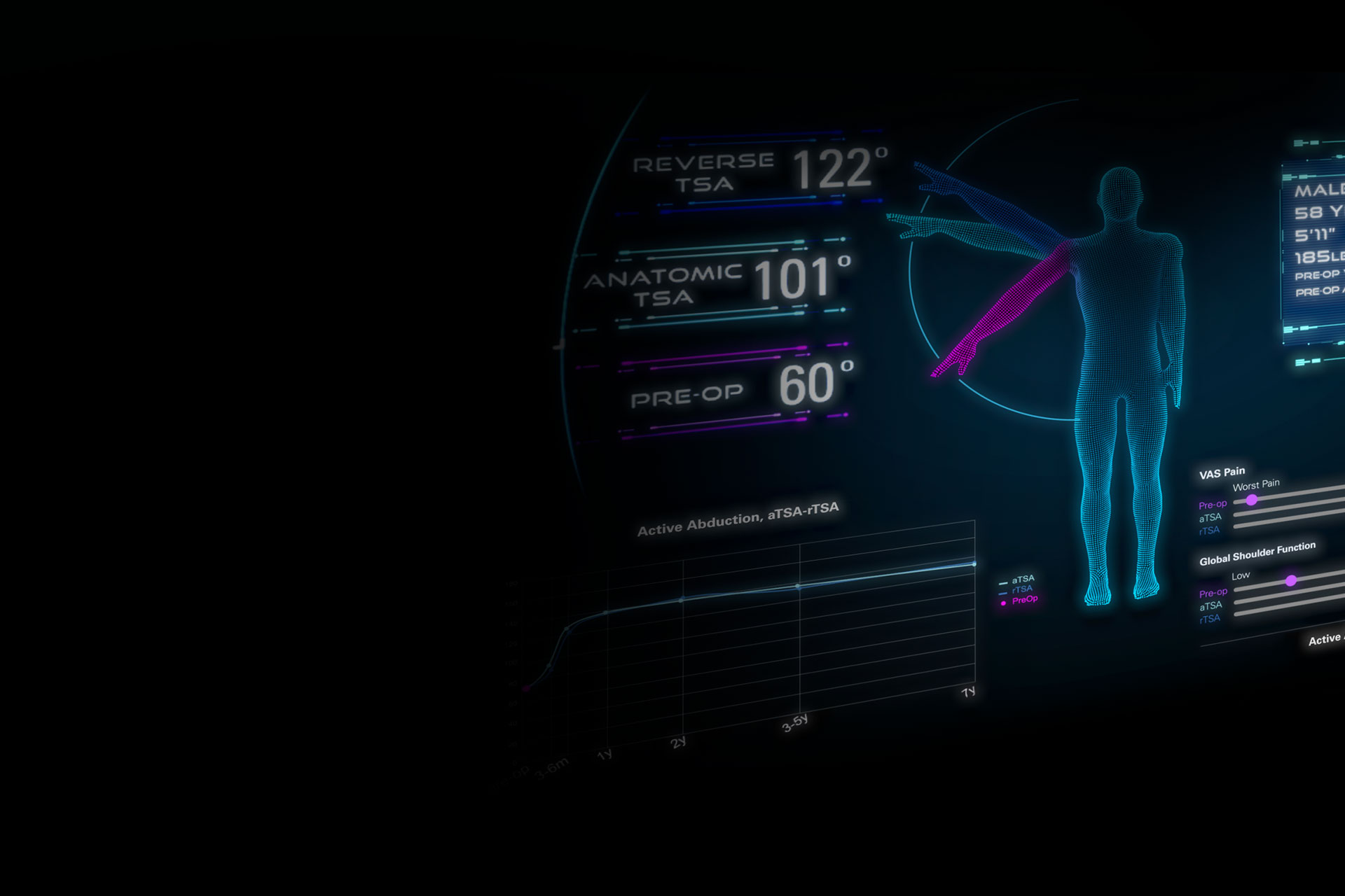 Predict+ Patient-Specific Outcome Predictor | Exactech