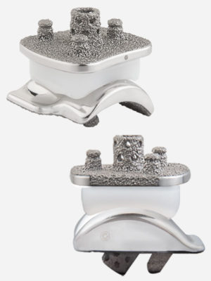 Ankle Replacement Surgery | Surgical Treatment Options | Exactech