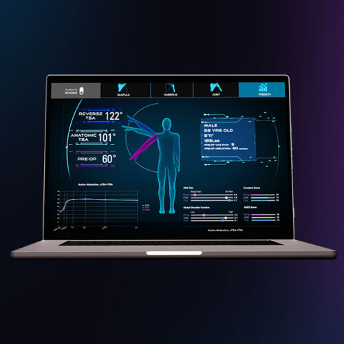 Active Intelligence | Exactech