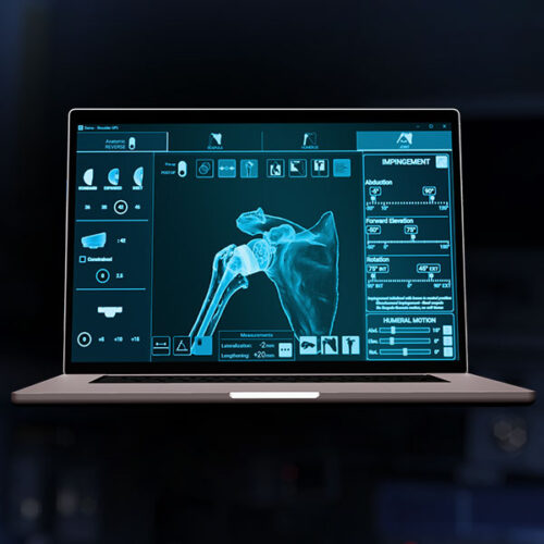 Active Intelligence | Exactech