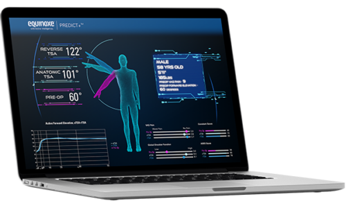 Equinoxe Planning App and GPS Shoulder - exac.co.uk